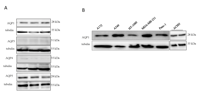 水通道蛋白1 (Aquaporin 1, AQP1)通过促进癌细胞内质膜泡的缩回阶段来调控细胞膜泡的形成