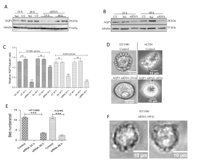 水通道蛋白1 (Aquaporin 1, AQP1)通过促进癌细胞内质膜泡的缩回阶段来调控细胞膜泡的形成